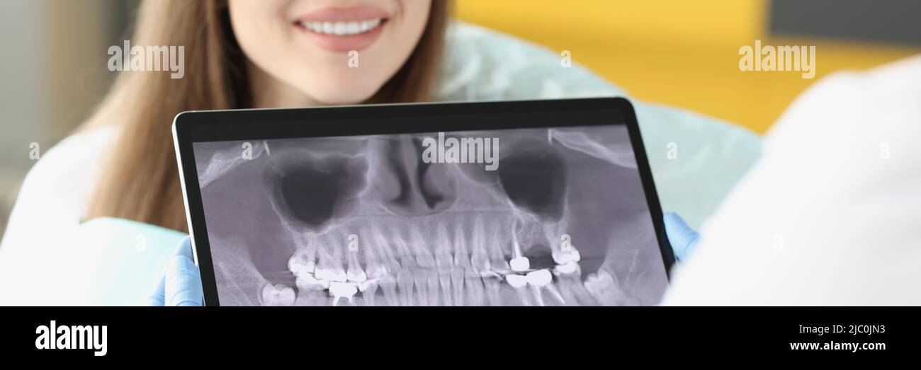 Dental consultation in clinic and doctor examine teeth x ray on digital ...