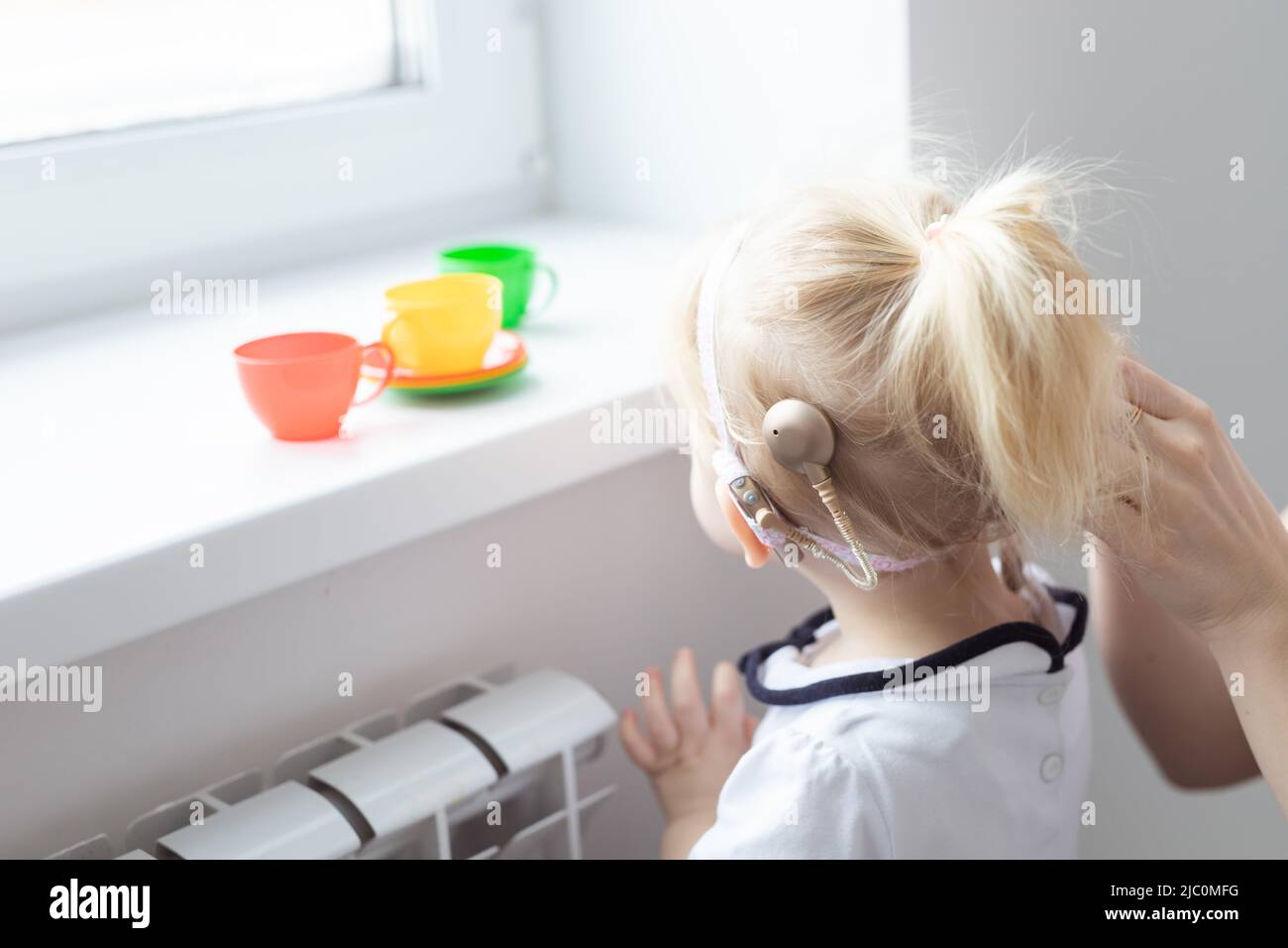 Cochlear implant on baby girl's head. Hearing aid and deafness concept ...