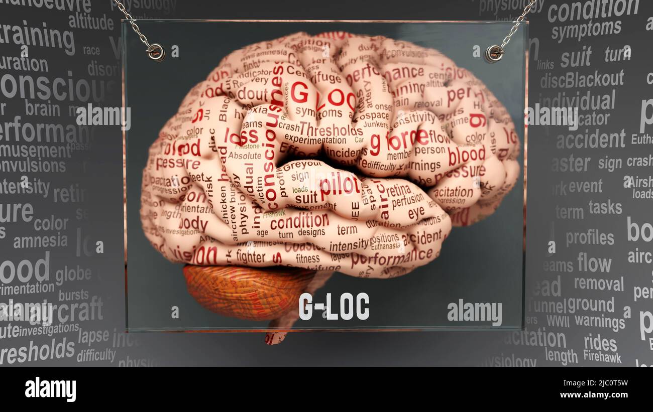 G loc in human brain - dozens of important terms describing G loc ...