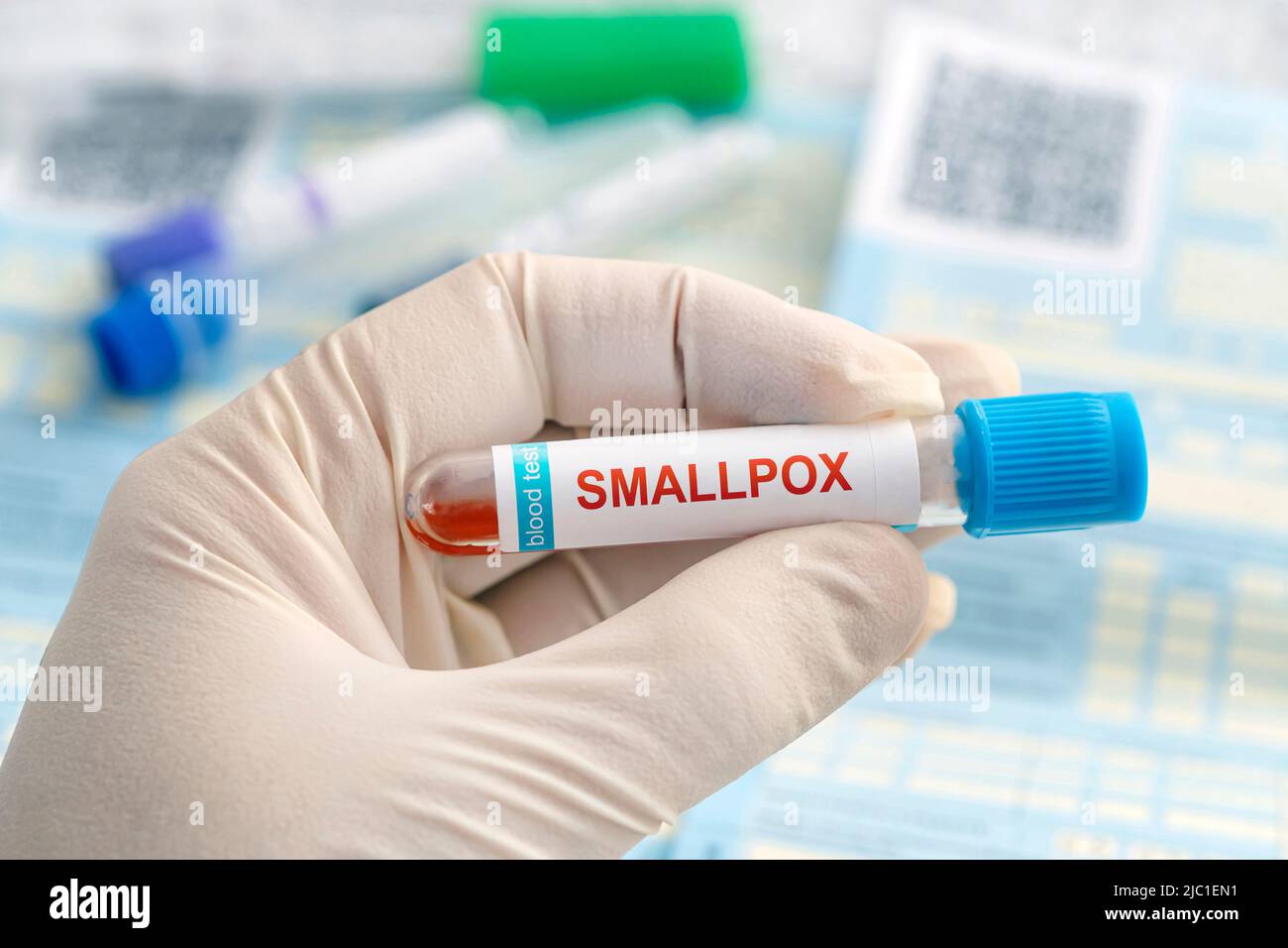 Closeup of female nurse with vacutainer with smallpox blood sample for ...