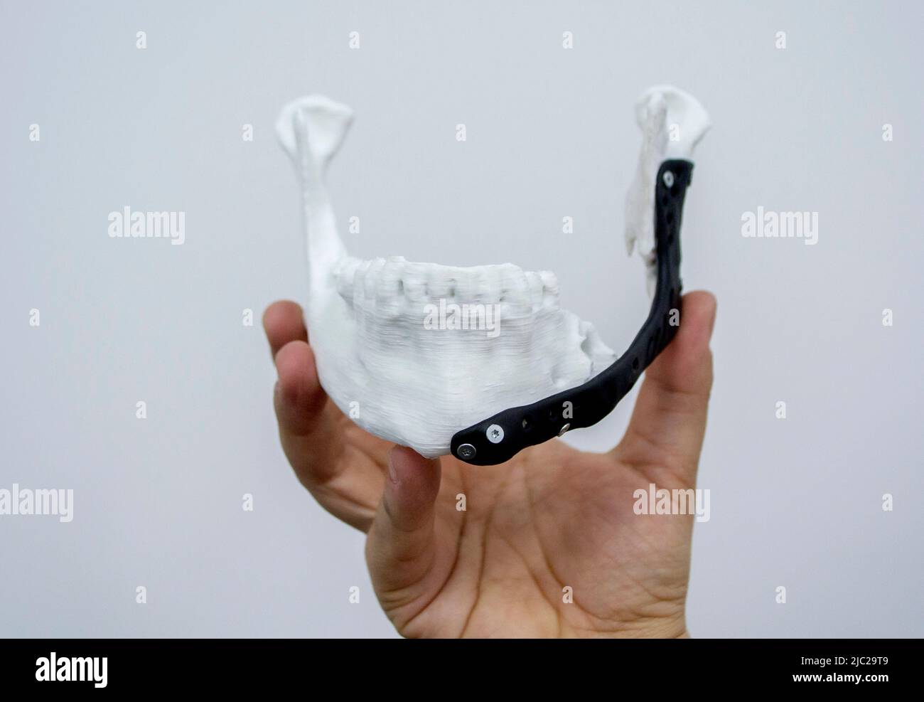 Man holding implantation of endoprosthesis of lower jaw. Model of lower ...