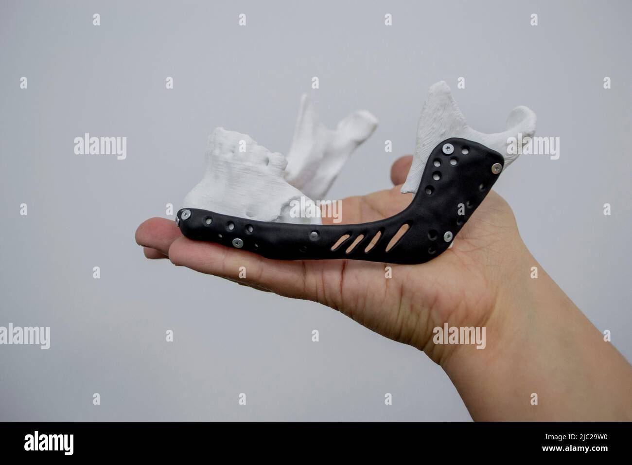 Facial mandibular prostheses hi-res stock photography and images - Alamy