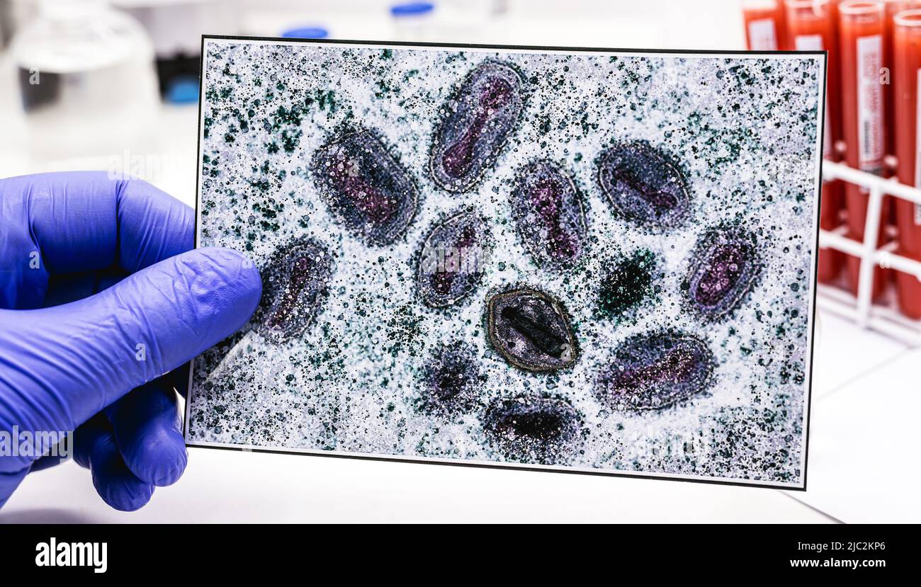 pharmacist's hand with latex glove holding monkeypox vaccine, with ...