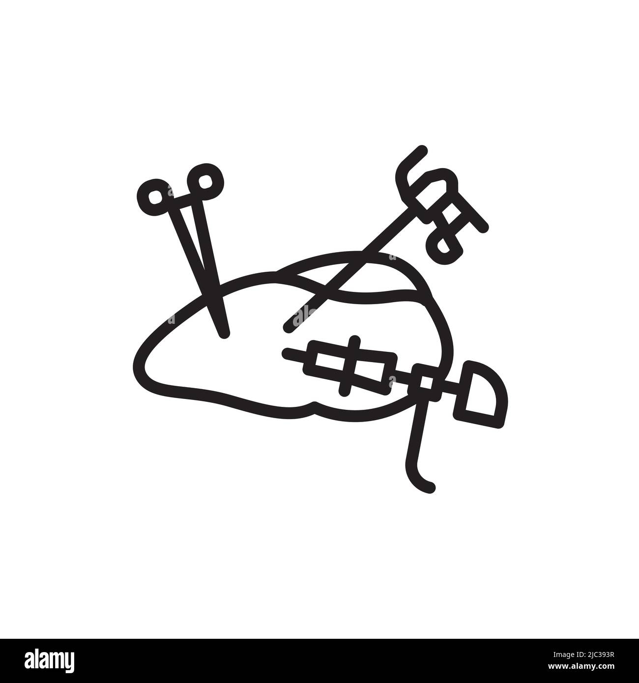 Lung surgery Black and White Stock Photos & Images - Alamy