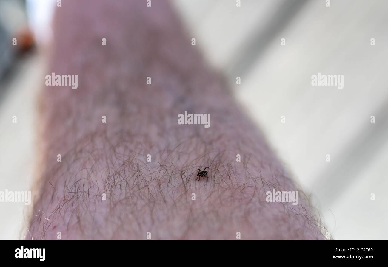 A single male dog tick crawling up leg hair on a Caucasian male Stock ...