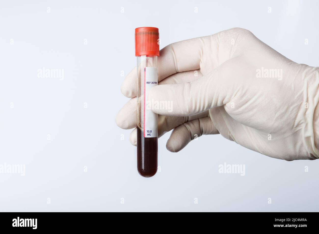 Handling blood probe for analyzing in a laboratory Stock Photo - Alamy