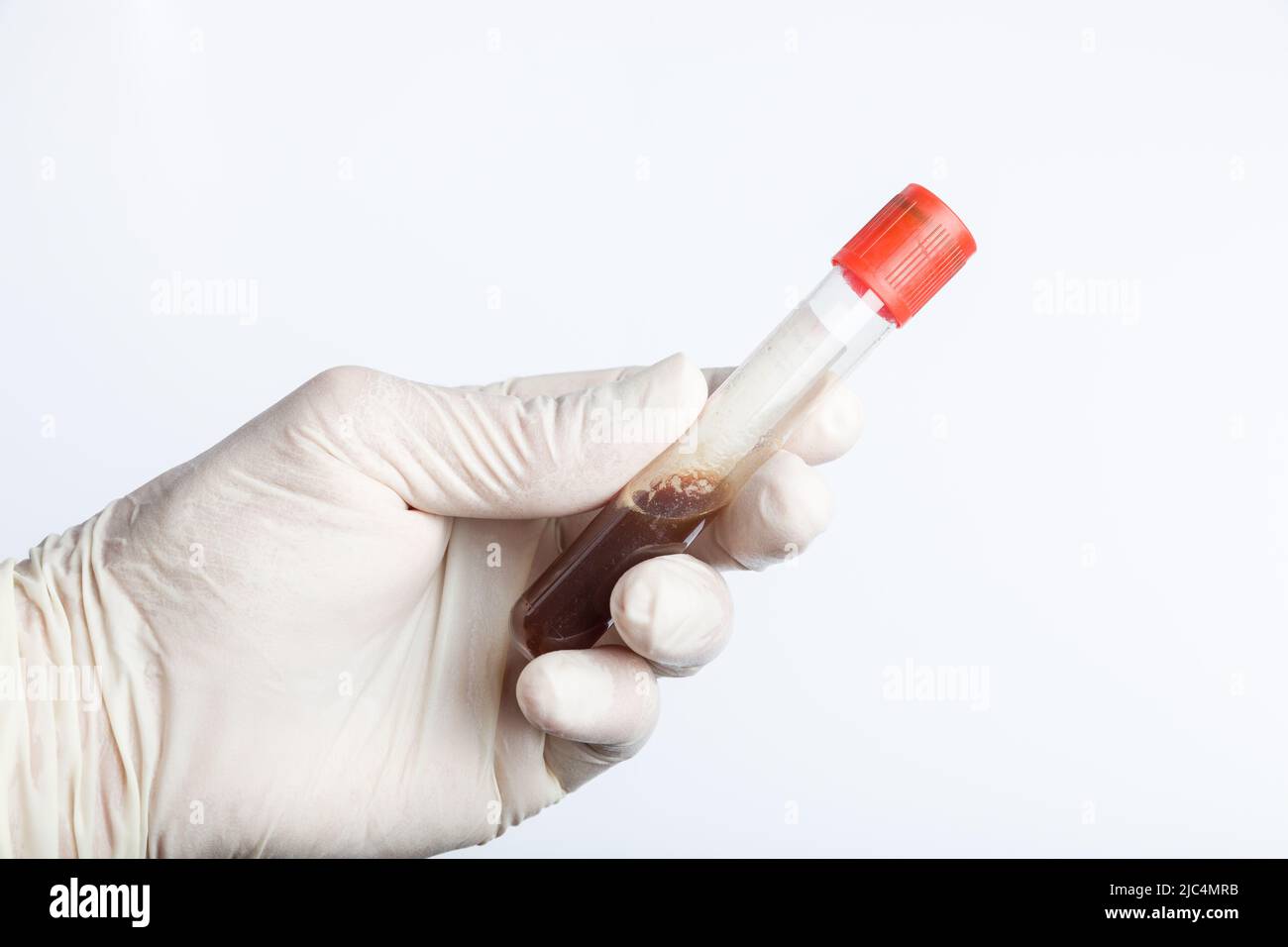 close-up of hands handling a blood probe for analyzing in a laboratory ...