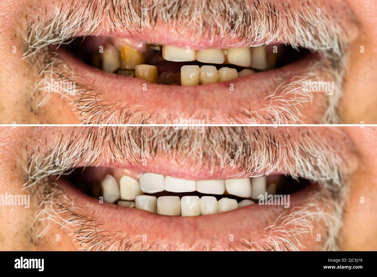 Close up medical dentistry tooth hi-res stock photography and images ...