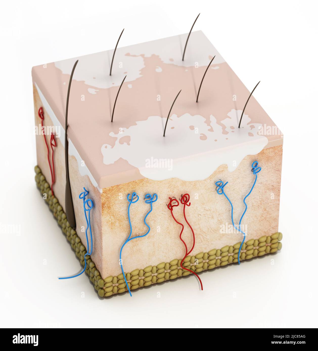 3D structure of a human skin section with vitiligo disease. 3D ...