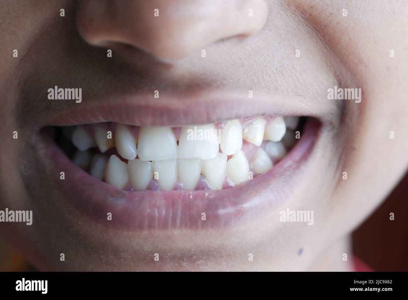teenage boy smiling with healthy white teeth Stock Photo - Alamy