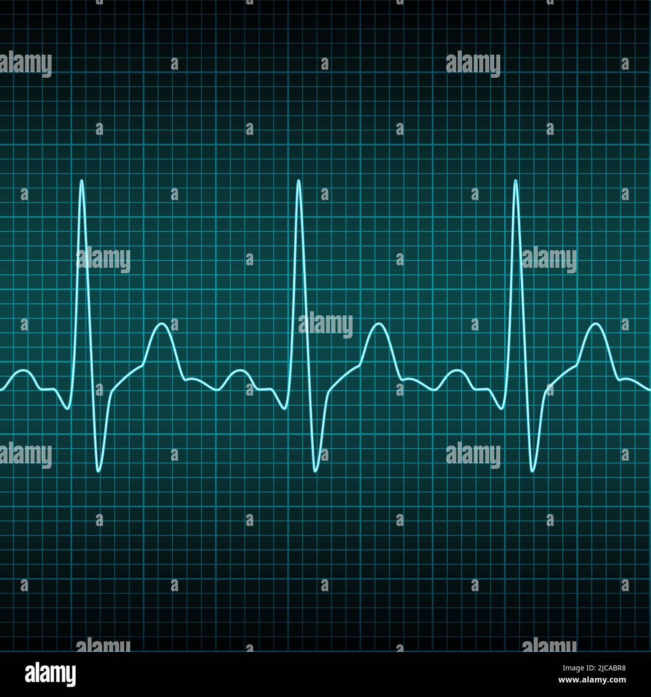 Electrocardiogram seamless background. Heart beat rate ekg recording ...