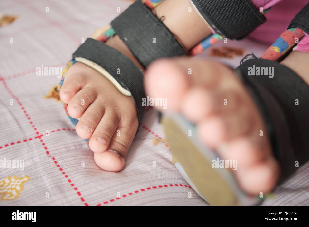 Child cerebral palsy disability, legs orthosis Stock Photo - Alamy