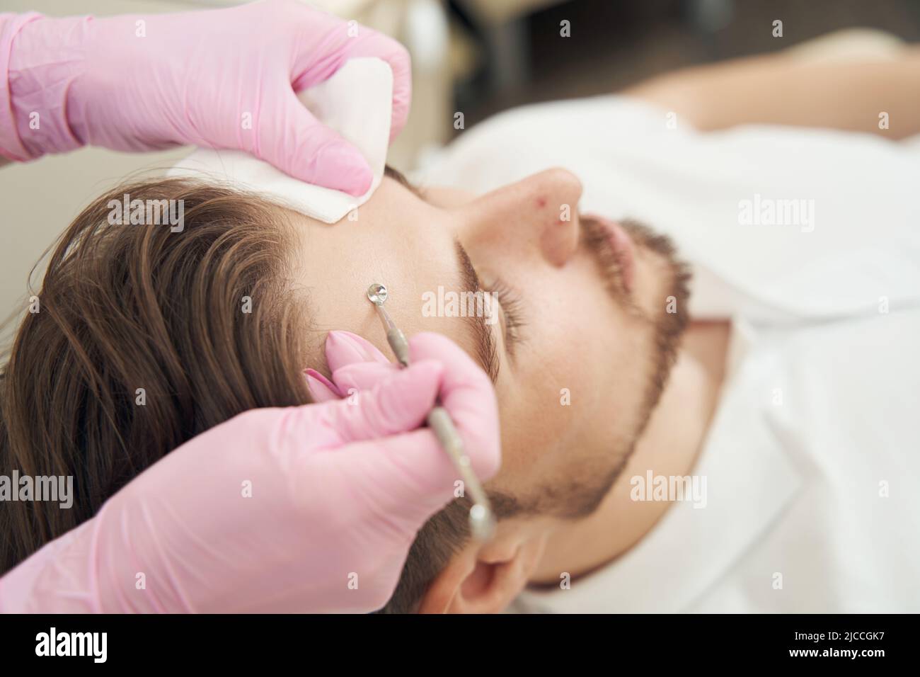 Beauty specialist cleaning pores on forehead with uno spoon Stock Photo ...