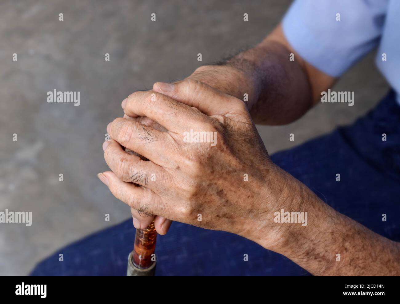 Hand of Southeast Asian elder man. Concept of rheumatoid arthritis ...