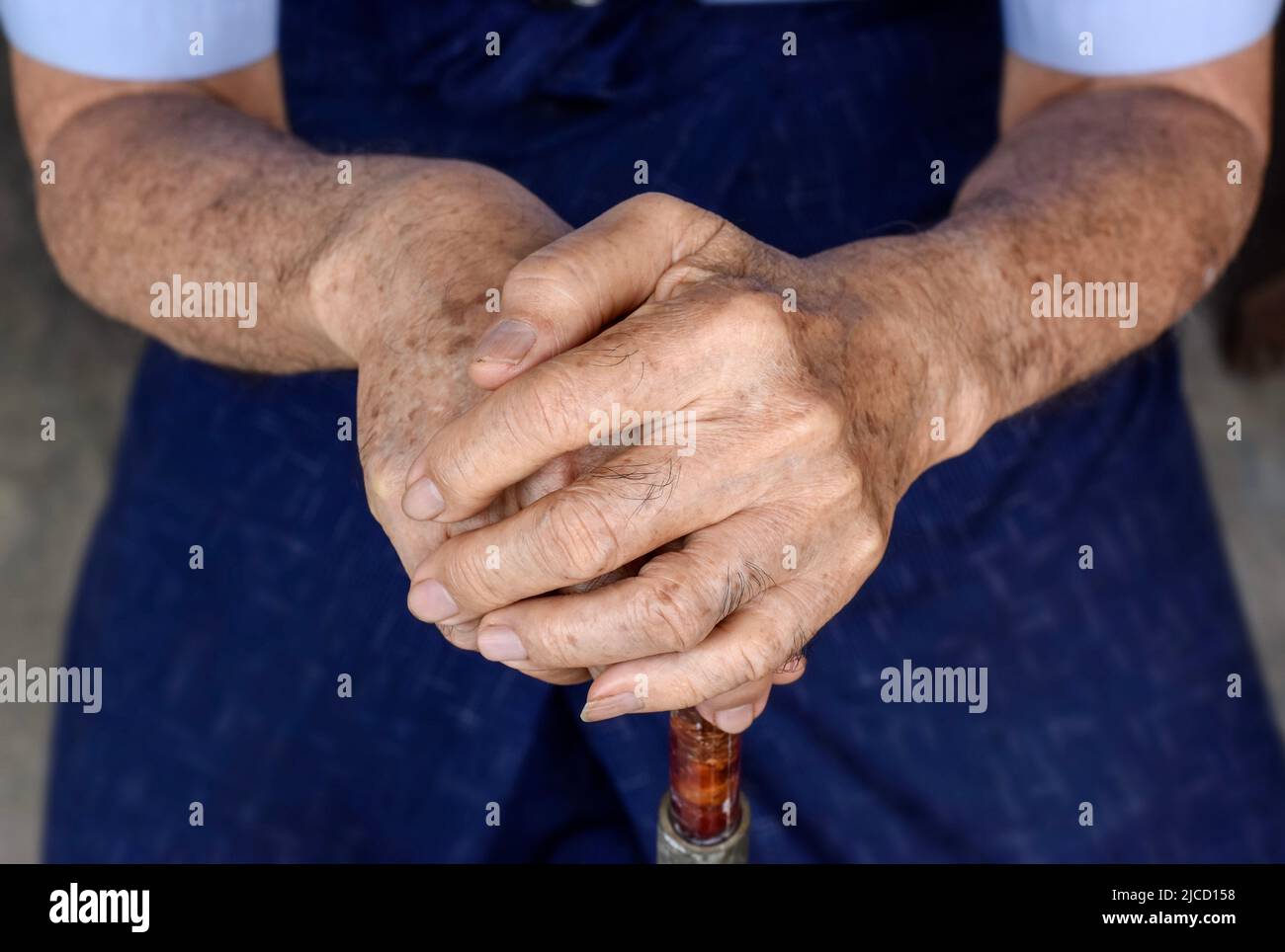 Hand of Southeast Asian elder man. Concept of rheumatoid arthritis ...