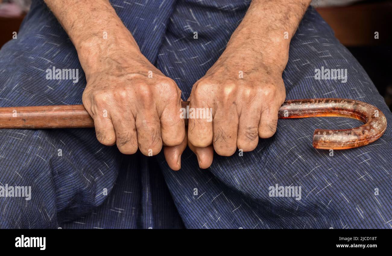 Hand of Southeast Asian elder man. Concept of rheumatoid arthritis ...