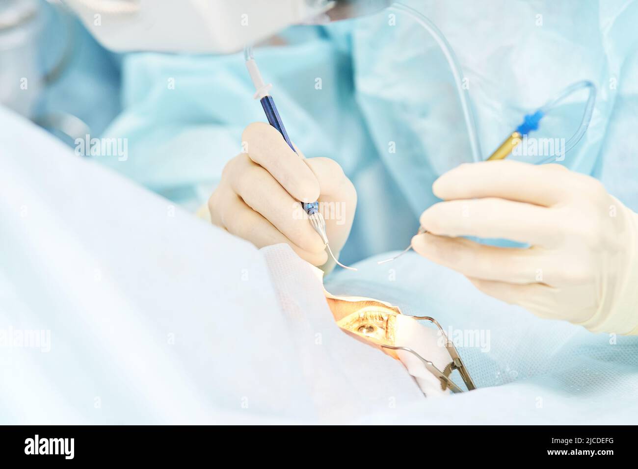 Ophthalmology laser microscope operation. Doctor surgery in clinic ...