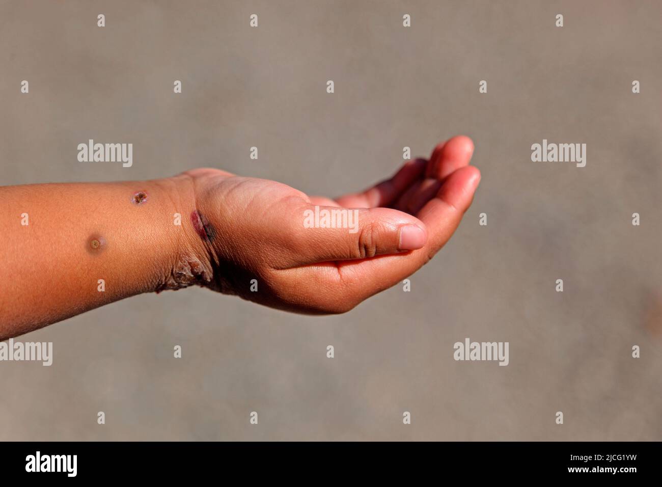 Monkey arm hi-res stock photography and images - Alamy