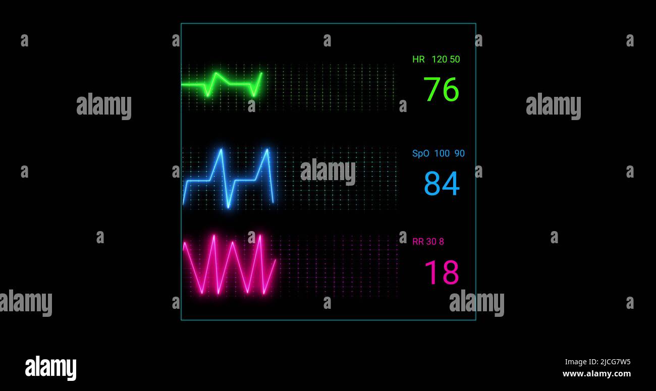 Image of cardiograph over black background Stock Photo - Alamy