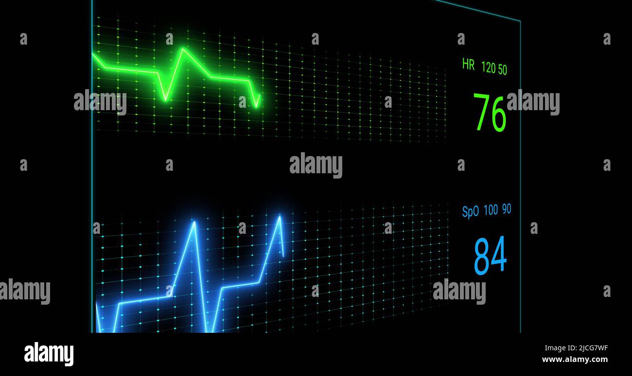 Cardiograph hi-res stock photography and images - Alamy