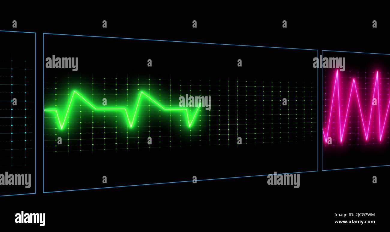 Image of cardiograph over black background Stock Photo - Alamy