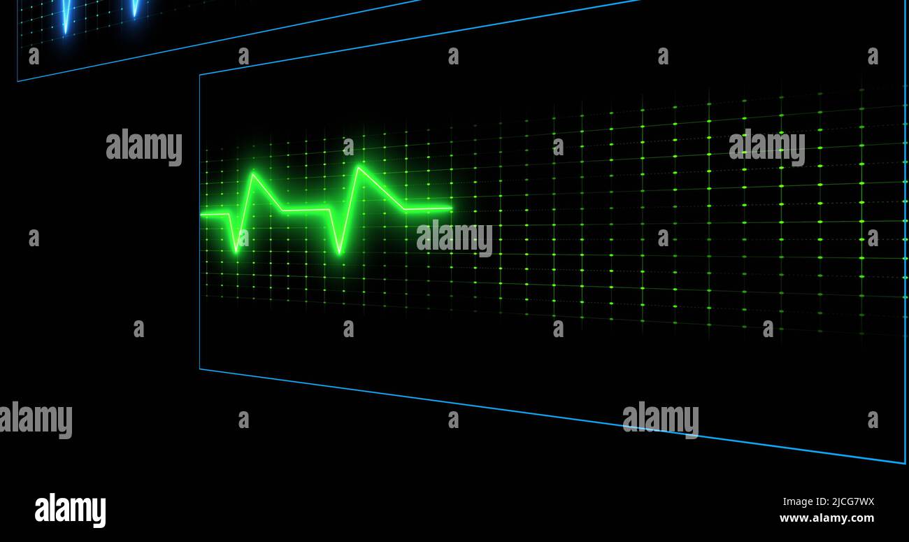Image of cardiograph over black background Stock Photo - Alamy