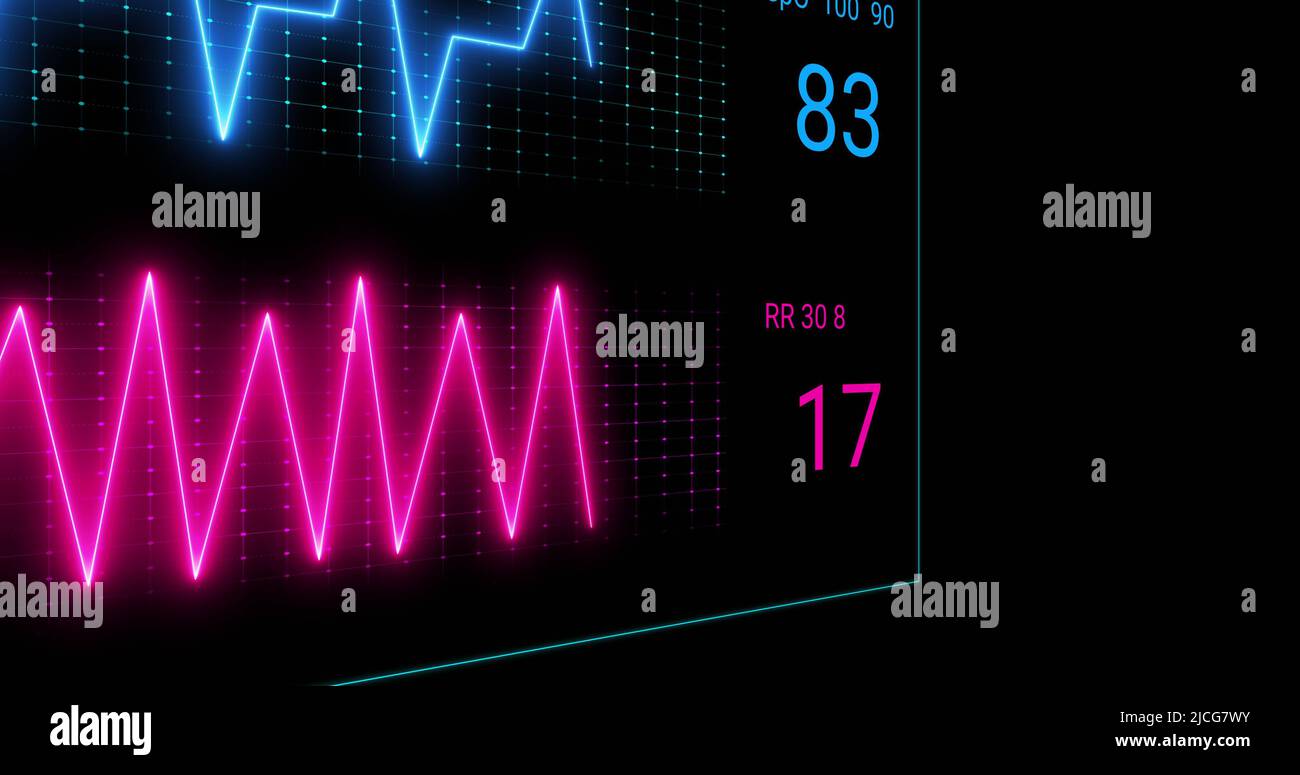 Image of cardiograph over black background Stock Photo - Alamy