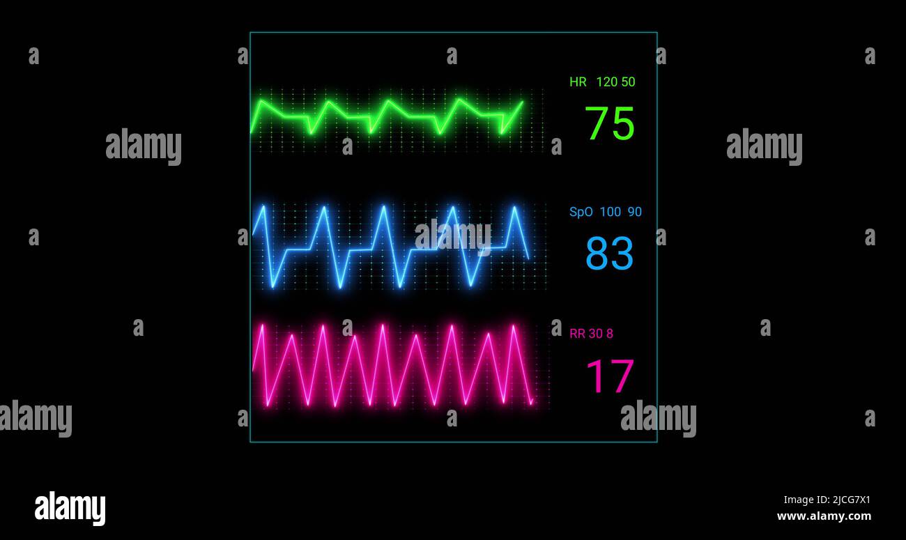 Cardiograph hi-res stock photography and images - Alamy