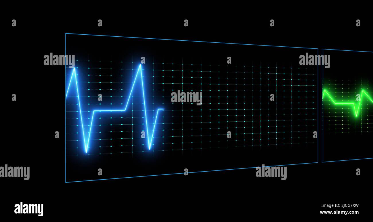 Image of cardiograph over black background Stock Photo - Alamy