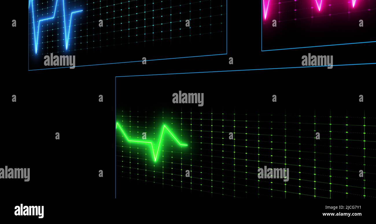 Image of cardiograph over black background Stock Photo - Alamy