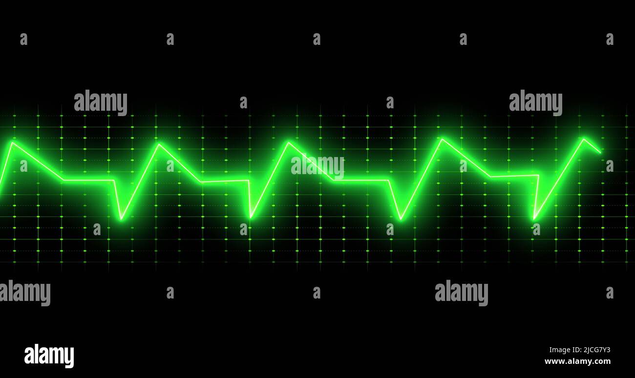 Image of cardiograph over black background Stock Photo - Alamy