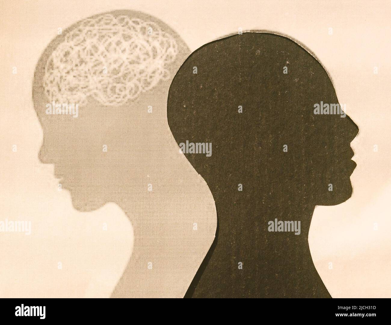 Human Brain Isolated Within Human Head and its shadow. Paper Abstract ...