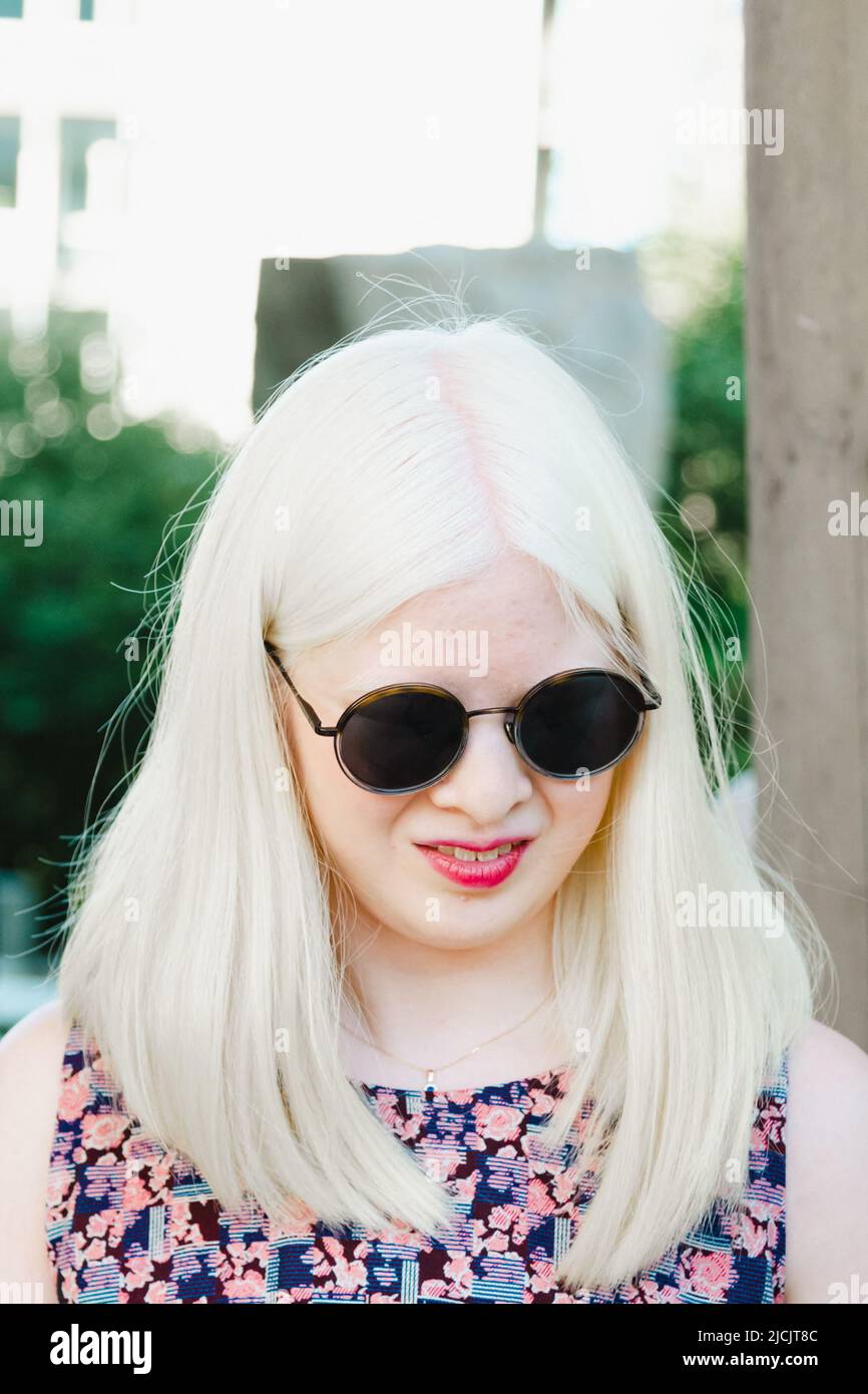 For the International Albinism Awareness Day, Audrey Azoulay, Director ...