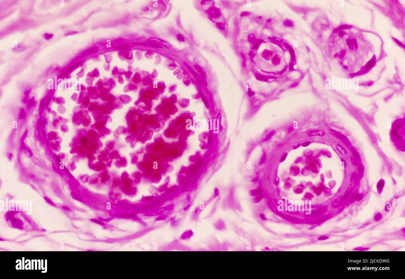 Microscopic View of Veins Stock Photo - Alamy