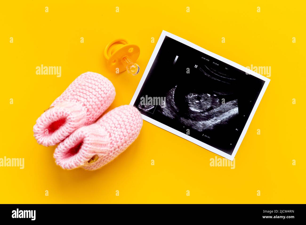 Pregnancy background. Baby accessories with ultrasound picture of ...