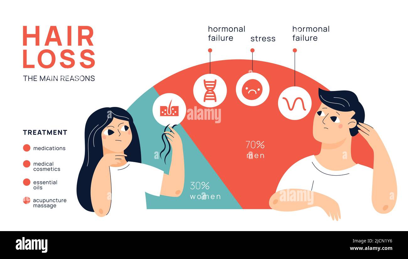 Hair Loss Infographic Male And Female Alopecia Hormonal Problem
