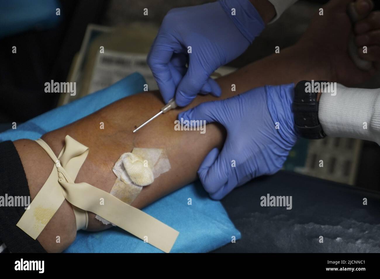 Detail of blood extraction at a red cross blood bank in San Salvador ...