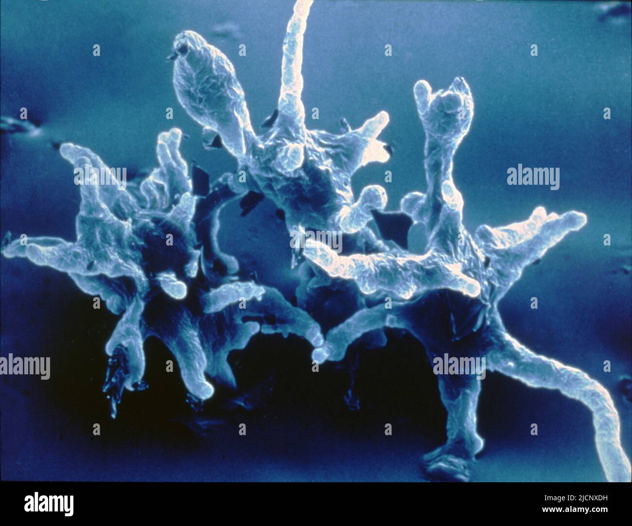 Amoeba, illustration. Amoeba are freshwater single-celled organisms that feed on bacteria and ...