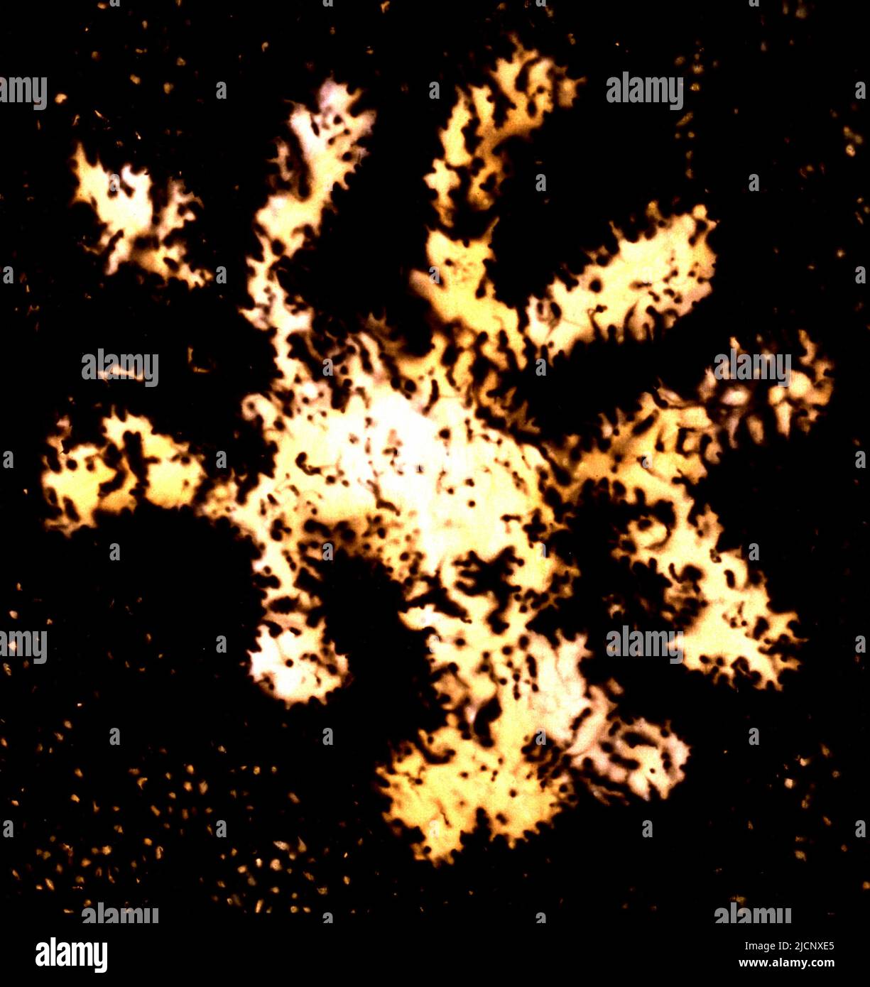 Illustration of immunoglobulin M (IgM), an antibody that responds to ...
