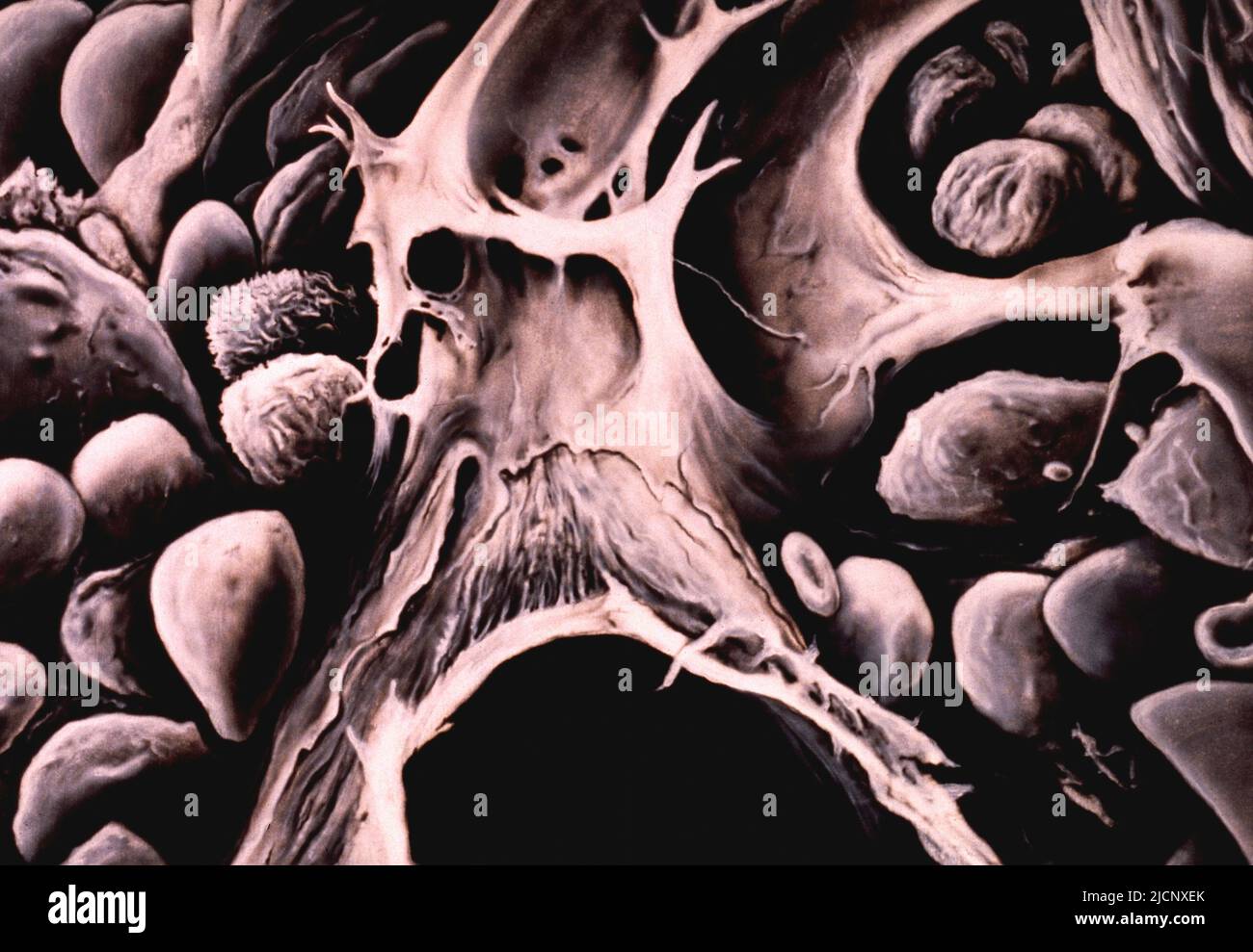 Bone marrow, illustration. Bone marrow contains stem cells which ...