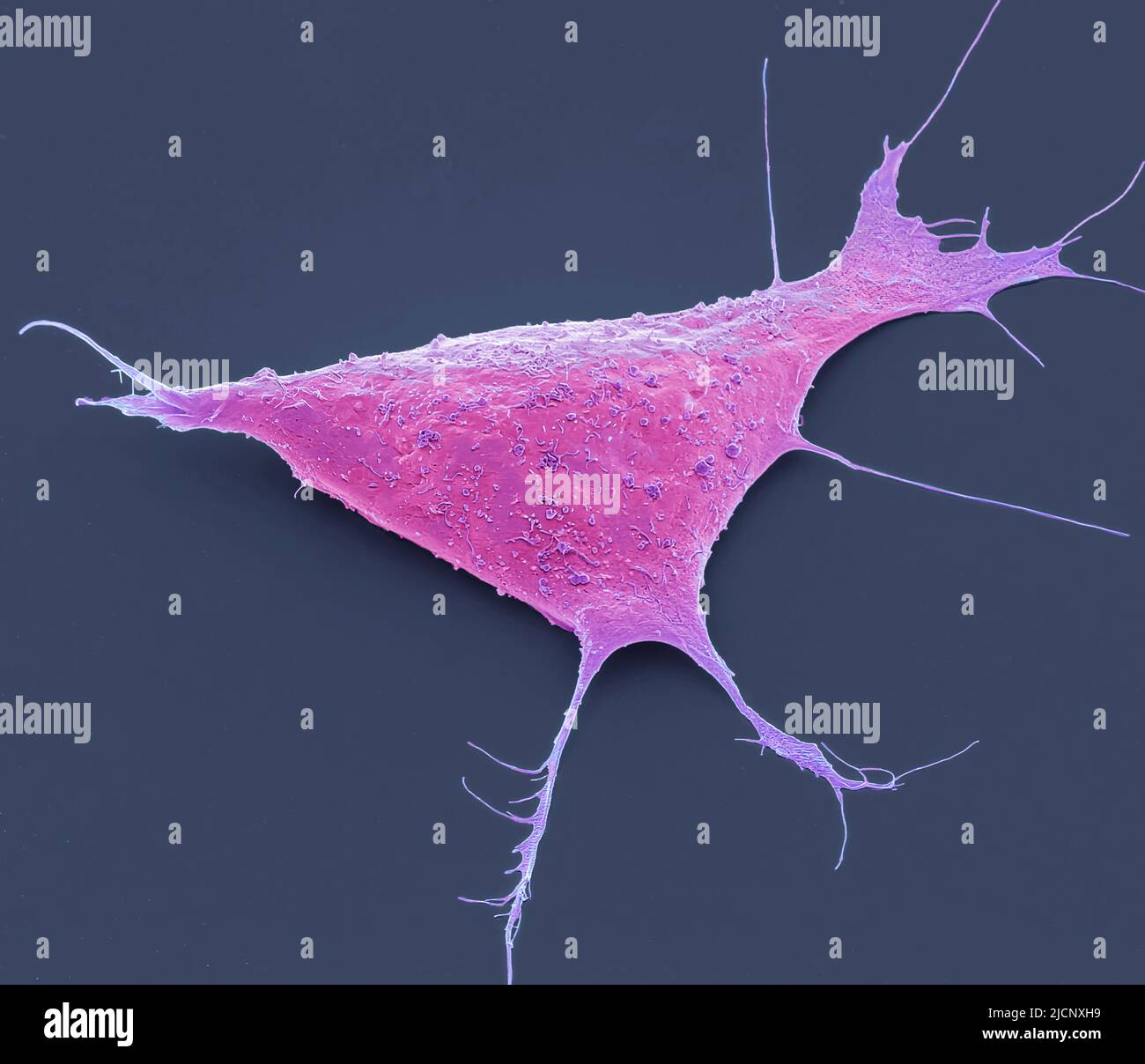 Human induced pluripotent cell. Coloured scanning electron micrograph ...