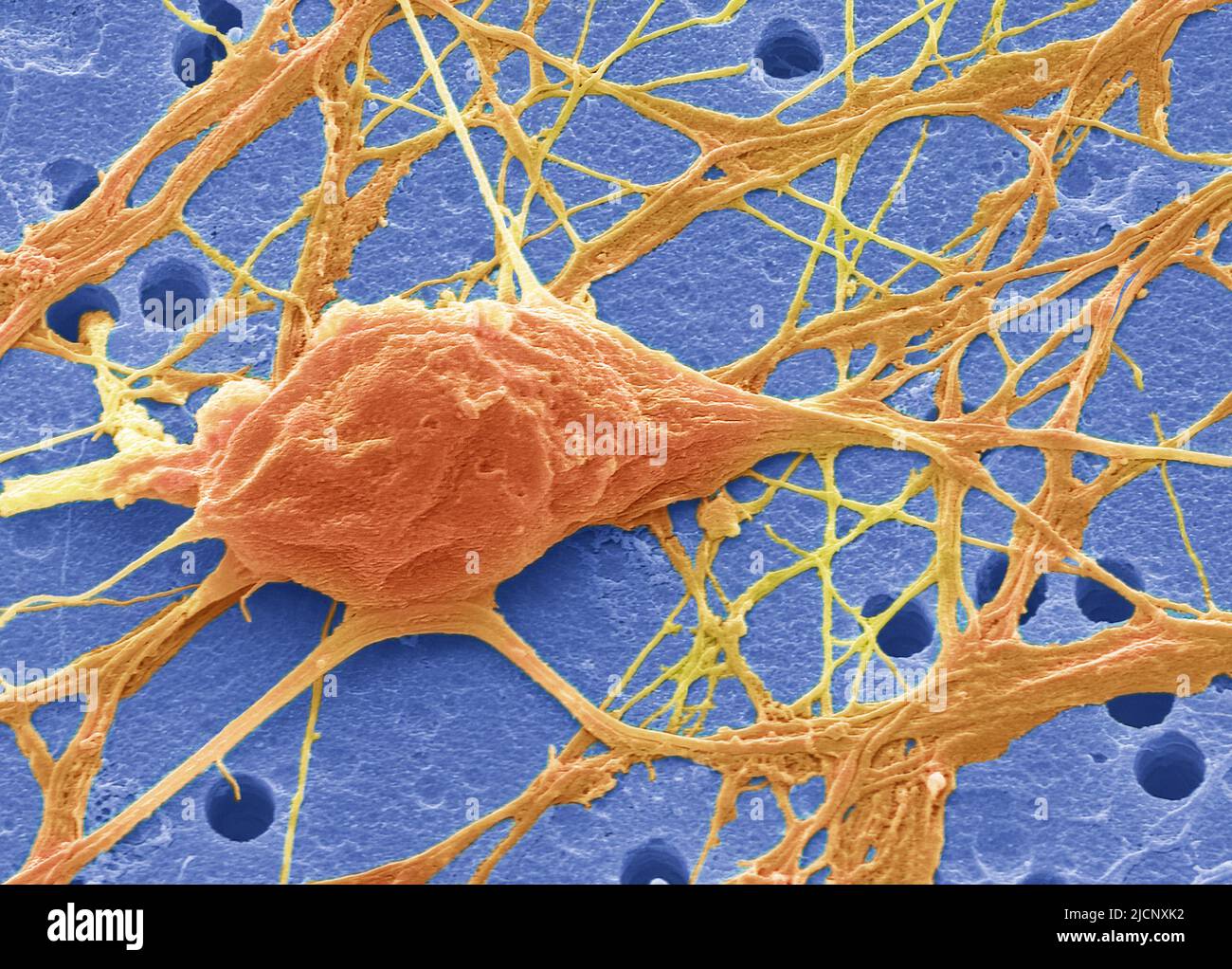 Pluripotent derived neurones. Coloured scanning electron micrograph ...