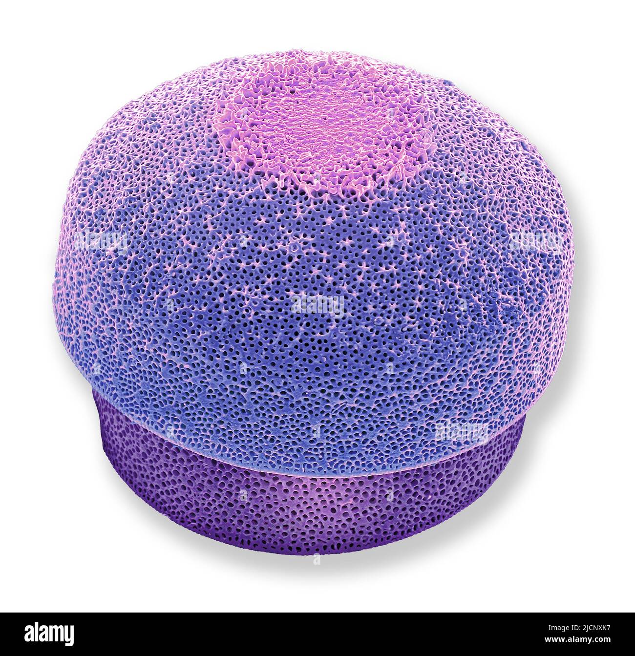 Diatom. Coloured scanning electron micrograph (SEM) of an Auliscus sp ...