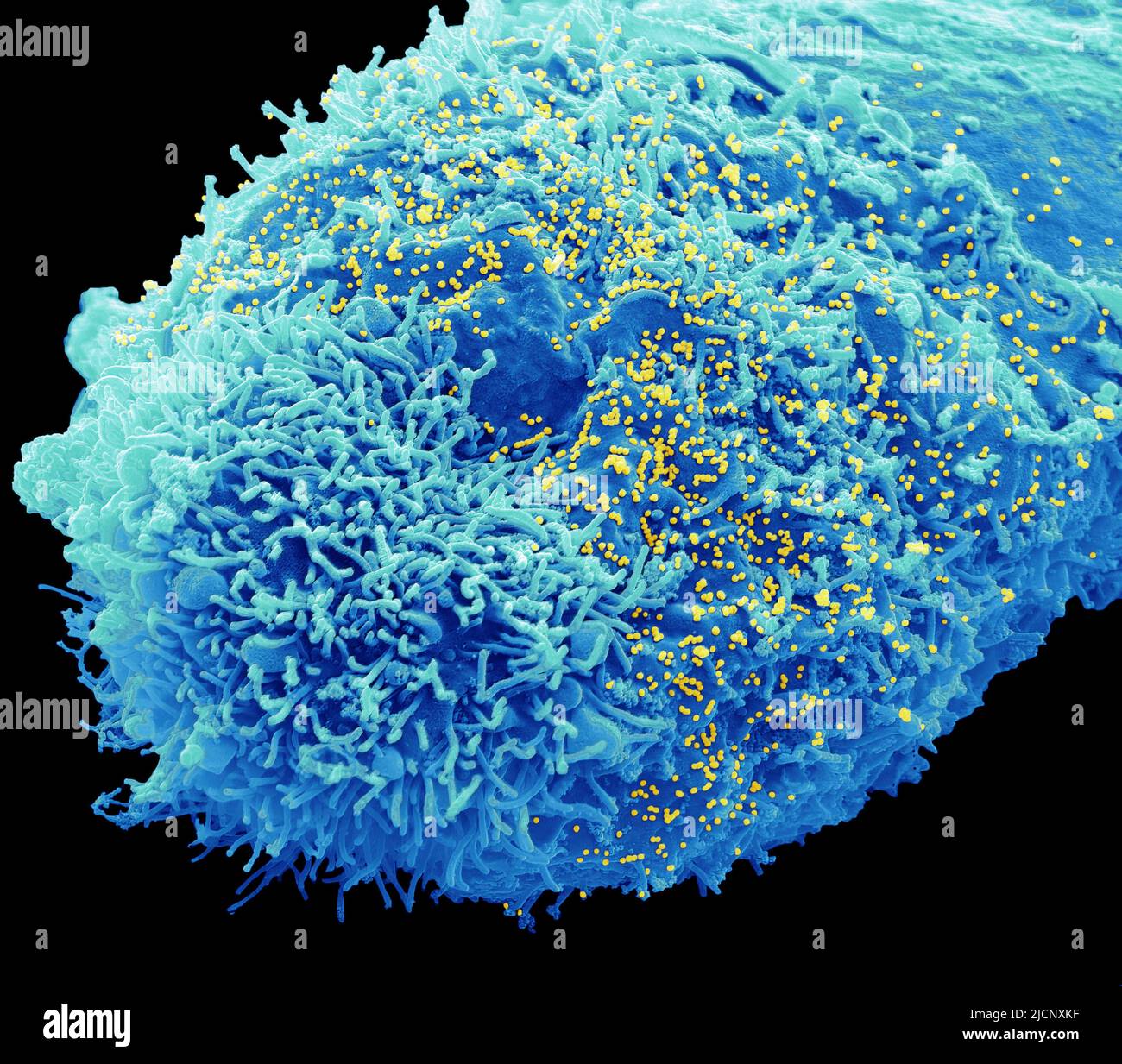 Sars Cov 2 Omicron Variant Coloured Scanning Electron Micrograph Sem Here The Omicron 
