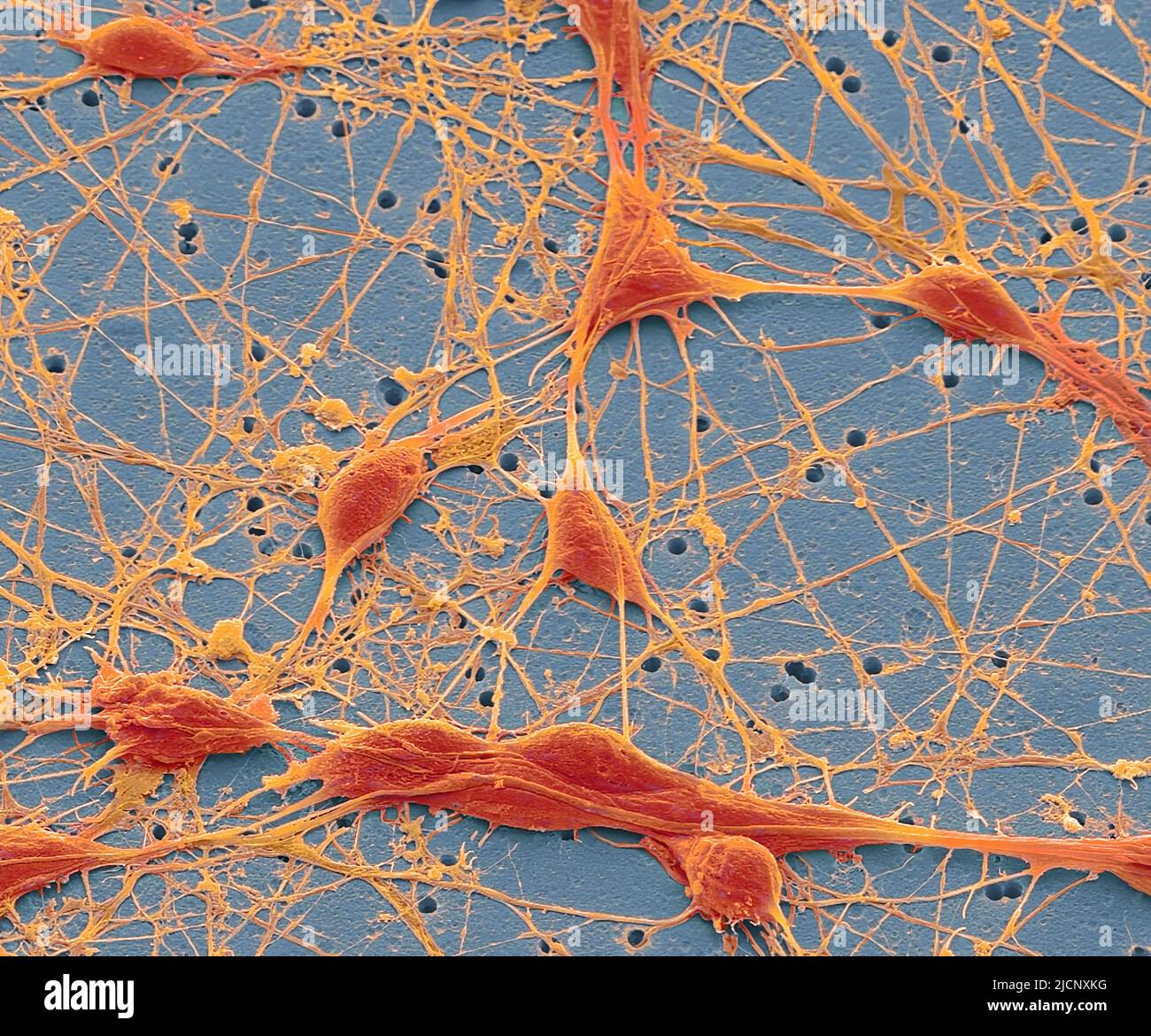 Pluripotent derived neurones. Coloured scanning electron micrograph ...