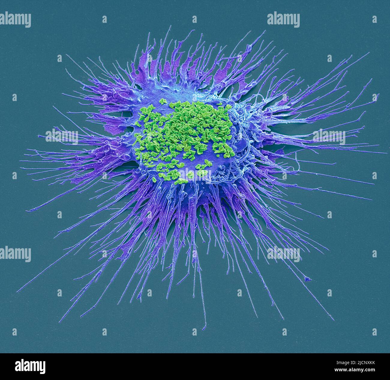 Mycoplasma. Composition coloured scanning electron micrograph (SEM) of ...