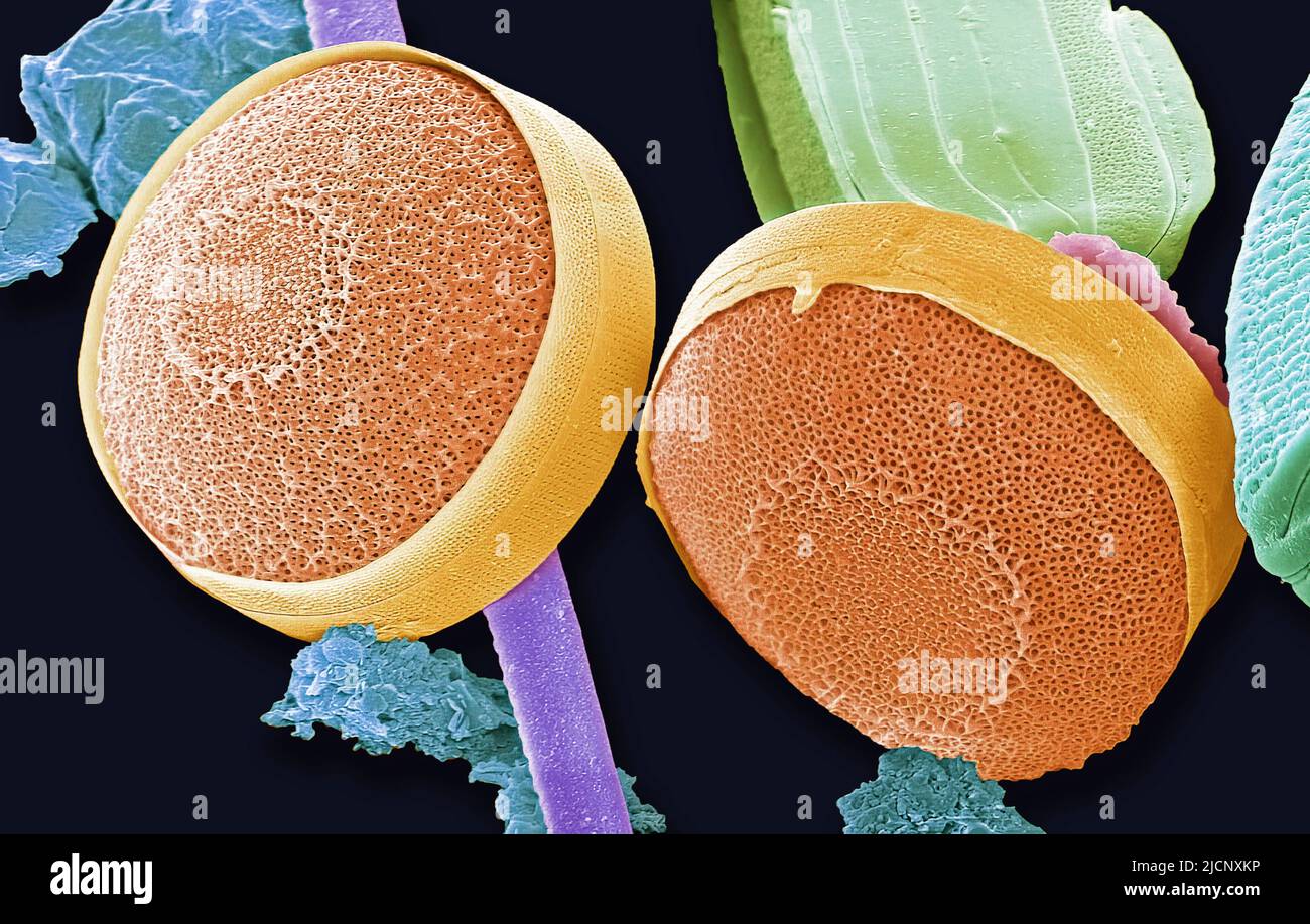 Diatoms. Coloured scanning electron micrograph (SEM) of melosira sp ...