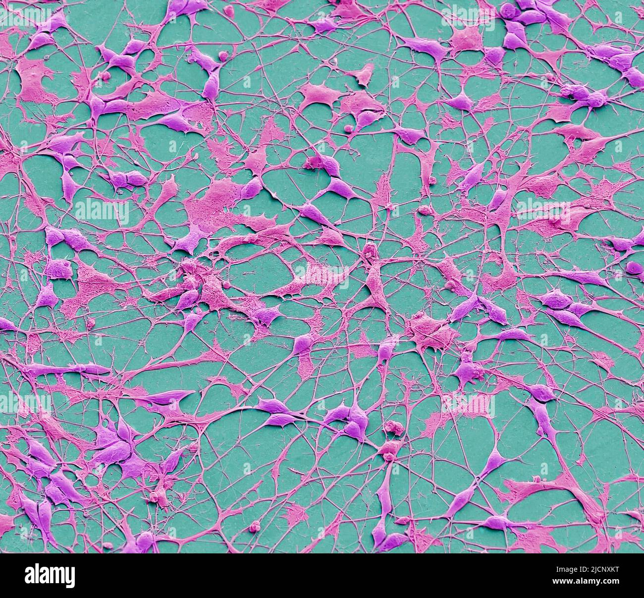 Pluripotent derived neurones. Coloured scanning electron micrograph ...