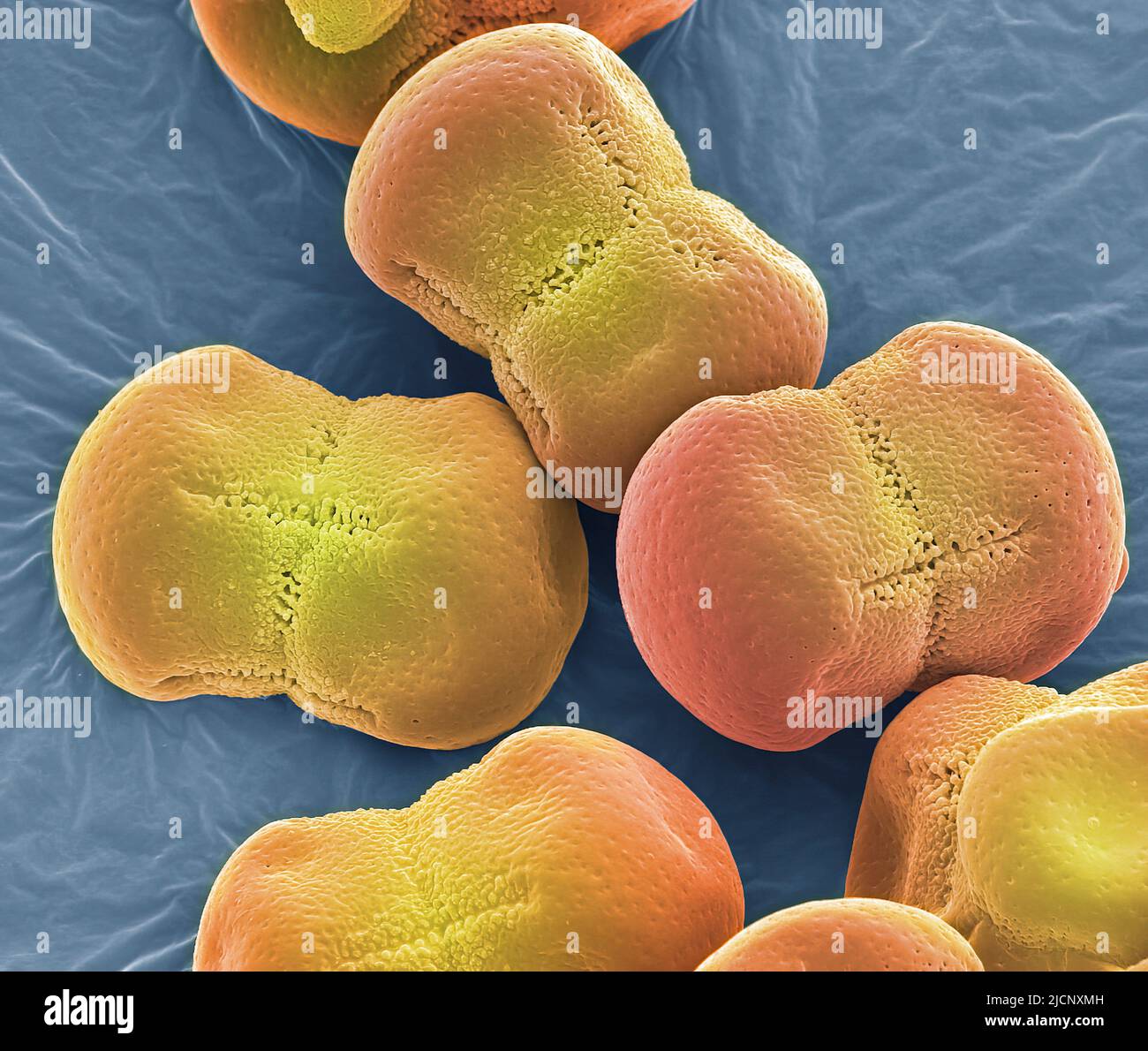 Pollen of Pulmonaria. Coloured scanning electron micrograph (SEM ...