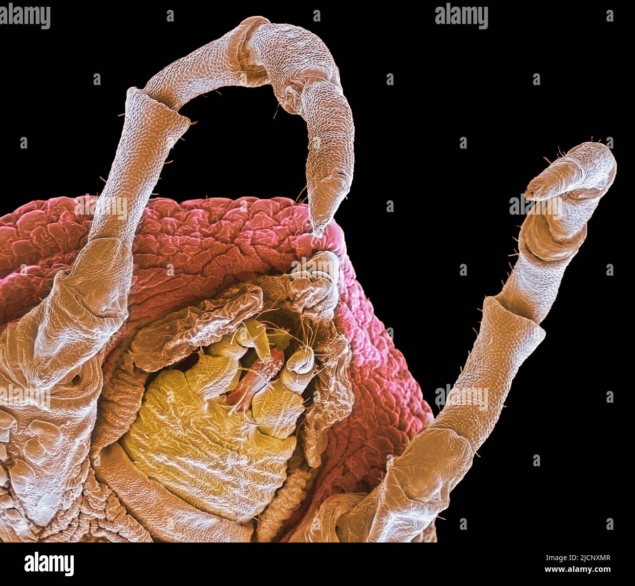 Ornithodoros tick. Coloured scanning electron micrograph (SEM) of an ...